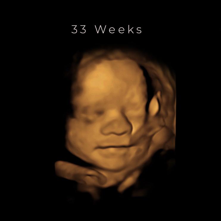 33 Weeks Pregnant Ultrasound